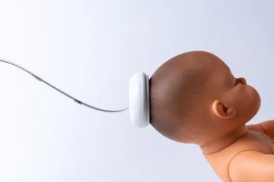 Você sabe utilizar o vácuo-extrator para auxiliar o parto? - Instituto ...